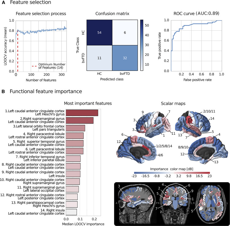 Robust Automated Computational Approach For Classifying Frontotemporal Neurodegeneration